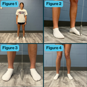 A Fitness Professional’s Introductory Guide to Assessing Static Posture ...