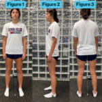 A Fitness Professional’s Introductory Guide to Assessing Static Posture ...